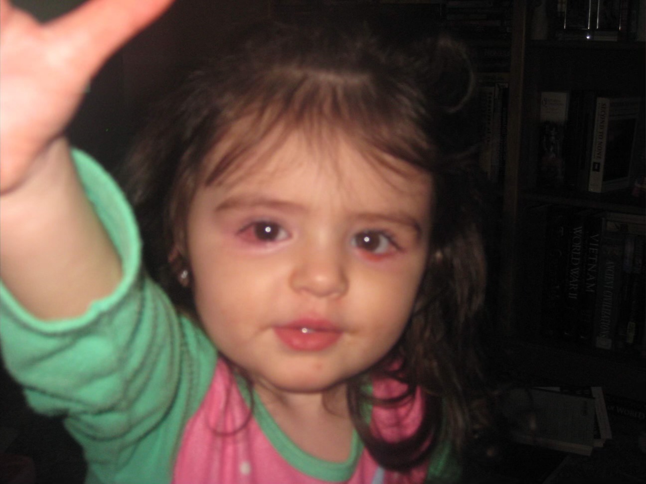 Meet Raeya: Cornea Transplant Recipient, Artist and Athlete